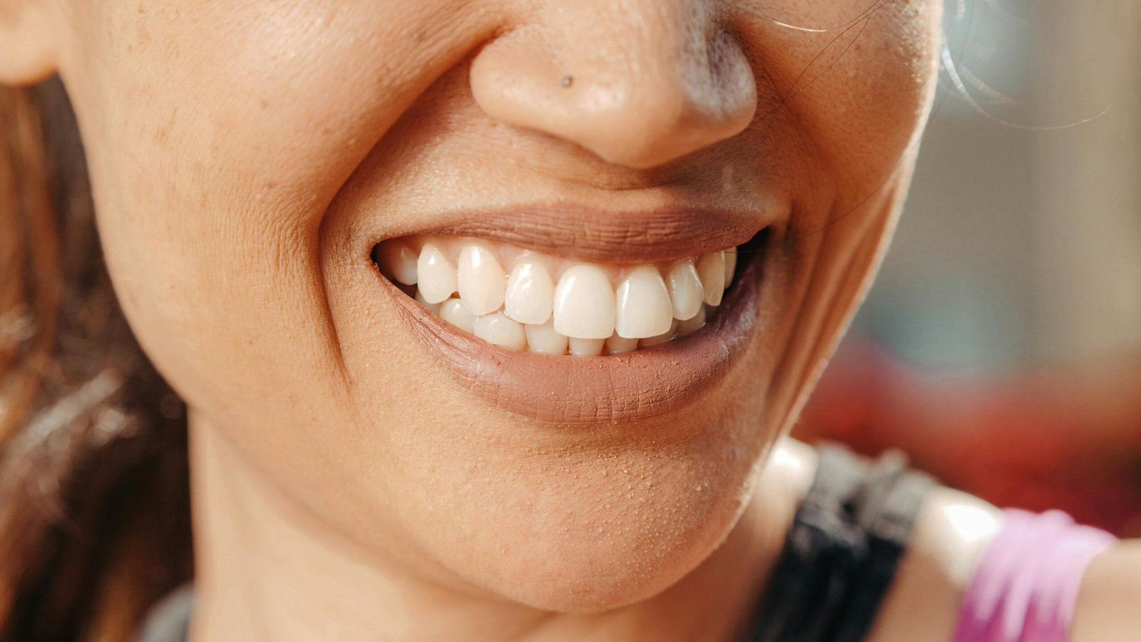Bloom White Teeth Whitening Powder: Really Works?